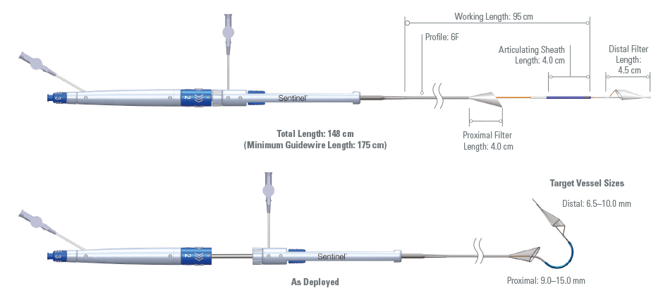 SENTINEL™ Cerebral Protection System - Boston Scientific